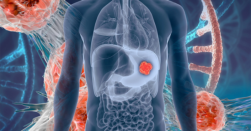 PeerView - Optimizing Novel HER2—Targeted Therapies and Other Agents in ...