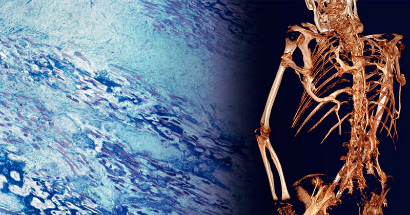 PeerView - Can YOU Avoid Iatrogenic Harm? Understanding and Identifying ...