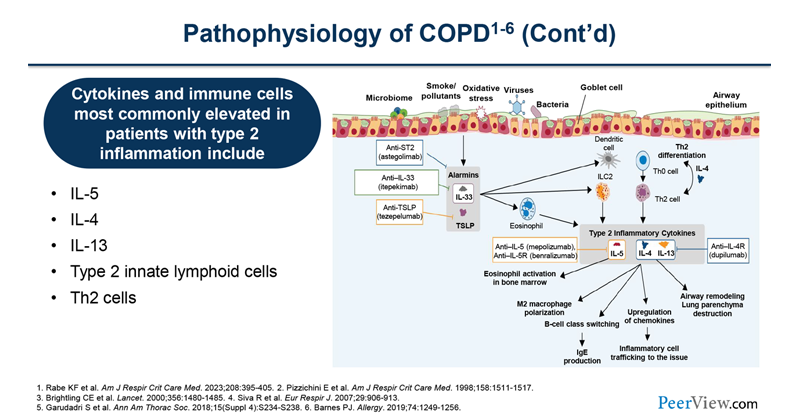 Cracking the Code in COPD: Understanding the Role of Type 2 ...