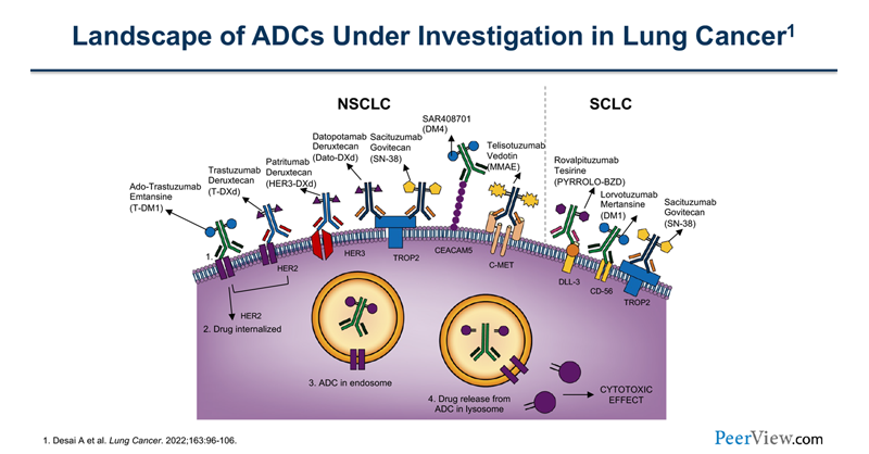 Are You Prepared for the New Wave of ADCs in NSCLC? Innovative Approaches and Practical ...