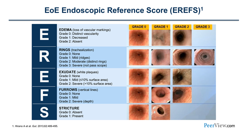 Updates in Eosinophilic Esophagitis: Exploring Underlying Mechanisms ...